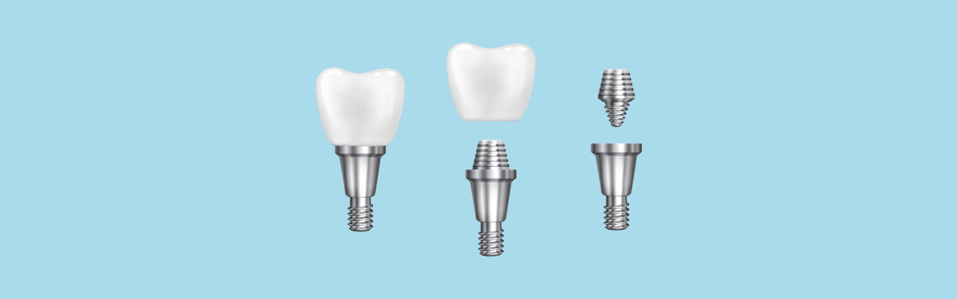 What Are Dental Implants? A Guide to Tooth Replacement